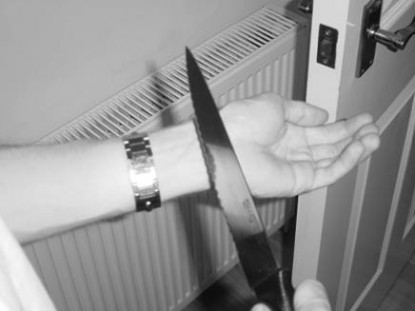 patterns of sharp force trauma :: www.forensicmed.co.uk