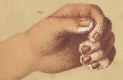 mechanisms of death :: www.forensicmed.co.uk