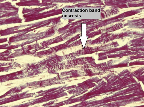 mechanisms of death :: www.forensicmed.co.uk