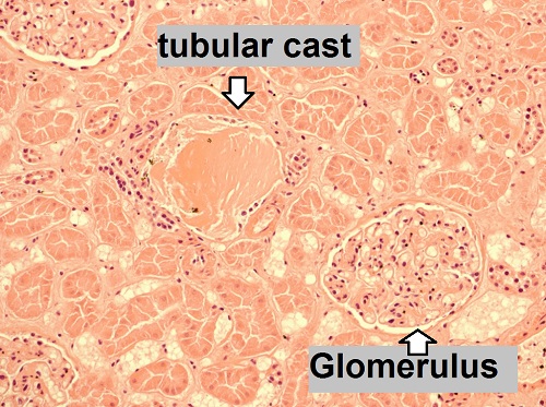 mechanisms of death :: www.forensicmed.co.uk