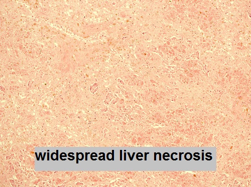 mechanisms of death :: www.forensicmed.co.uk